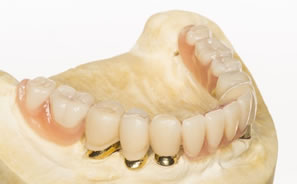 Prothetik / Zahnersatz